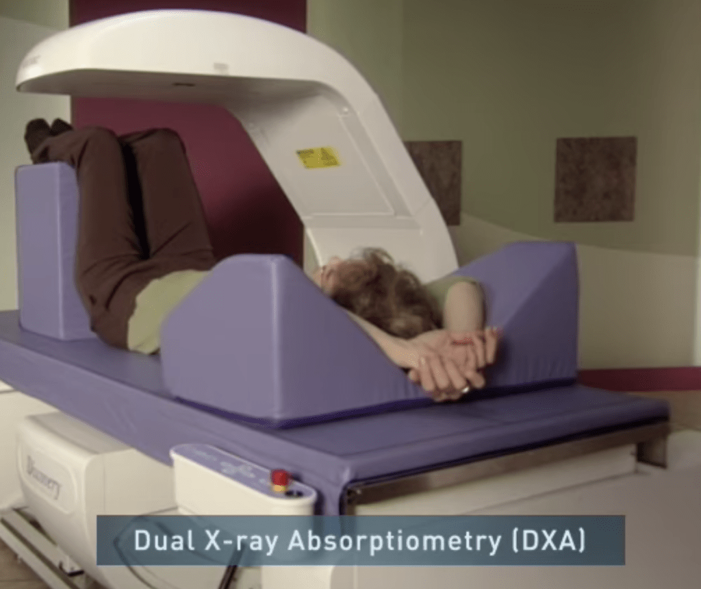 Hologic Discovery Dxa Bone Densitometry System Medical Outfitters